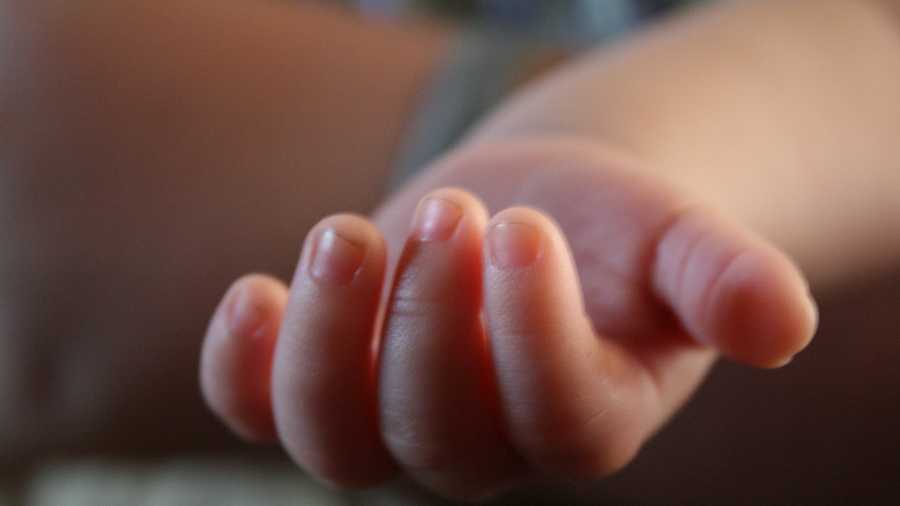 Cause for several babies born without hands, arms in France eludes ...