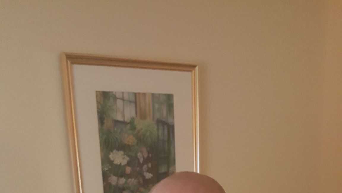 IMAGES: Louisville baby with rare condition travels country for treatment