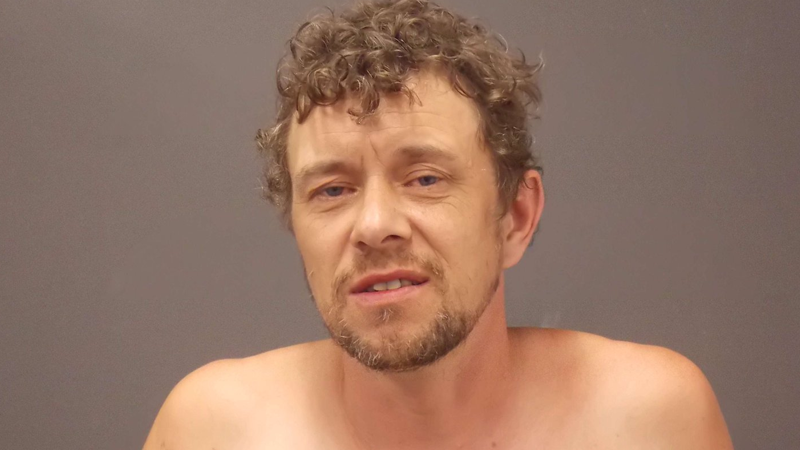 Police search for man who bit off portion of victim's ear