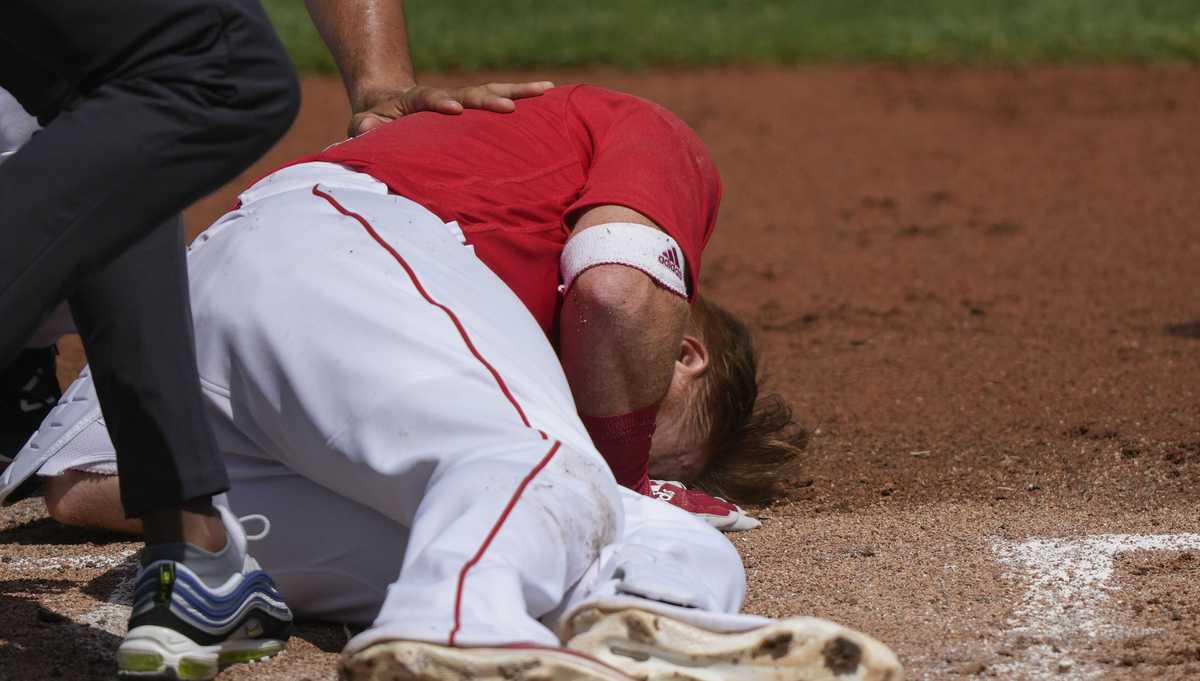 Red Sox's Justin Turner hit in face during spring training