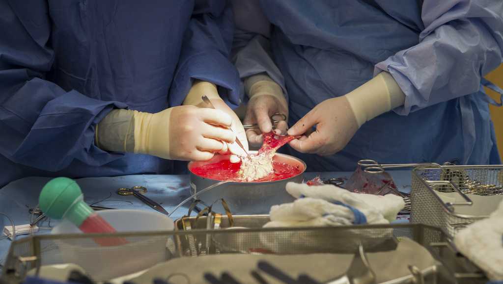 Donating a kidney is even safer now than thought, US study shows