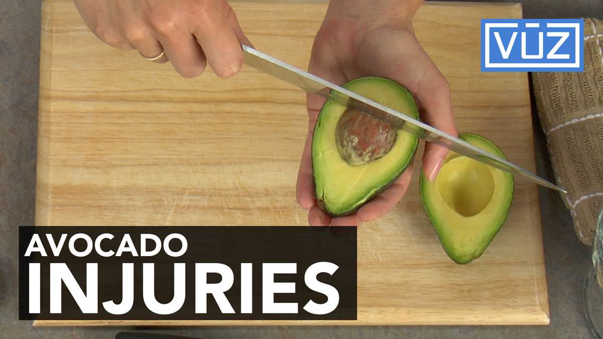 'Avocado hand' is sending people to the hospital