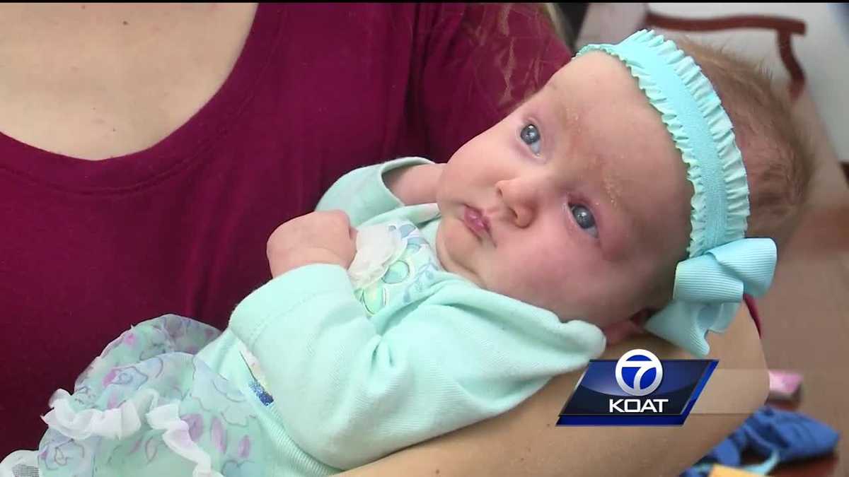 Baby girl who gave hope to so many turns 1