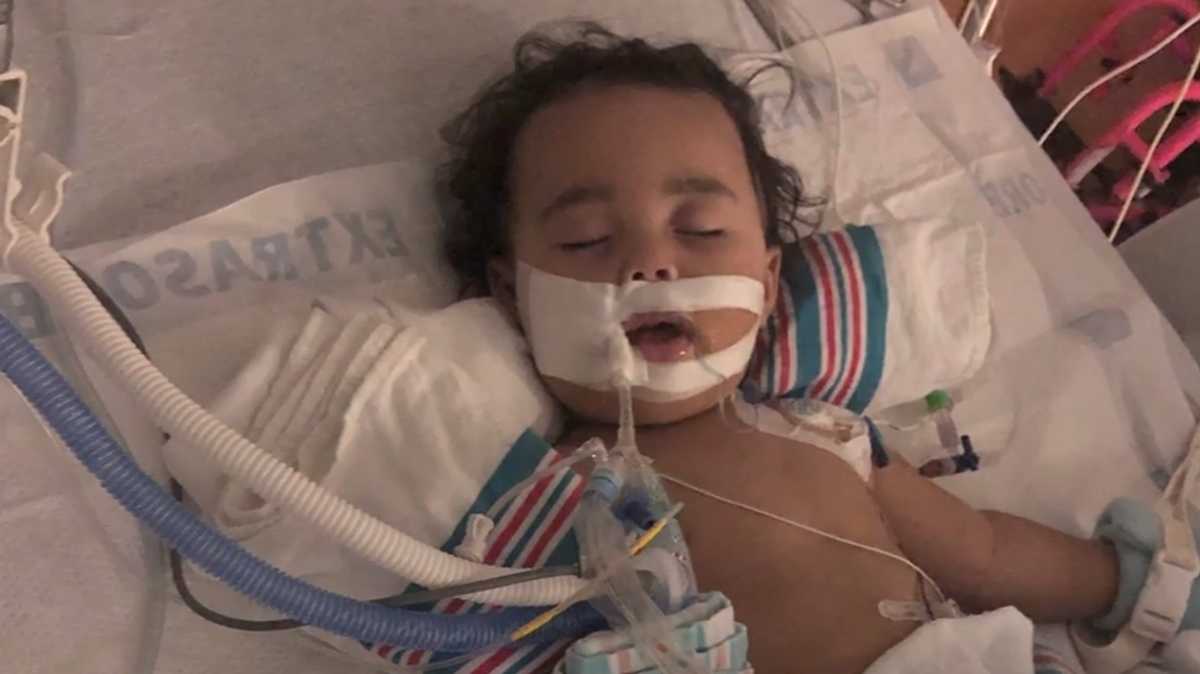 Toddler's esophagus badly burned after he swallows button battery