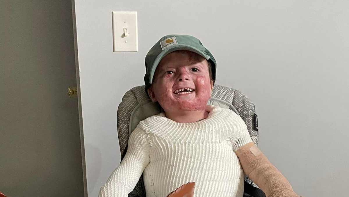 South Carolina: Boy burned in kidnapping crash home from hospital
