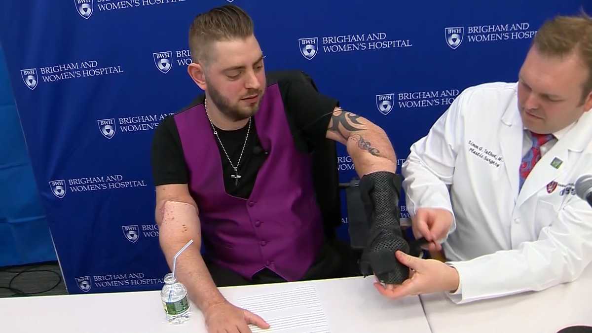 Wounded warrior who lost limbs in Afghanistan gets arm transplant