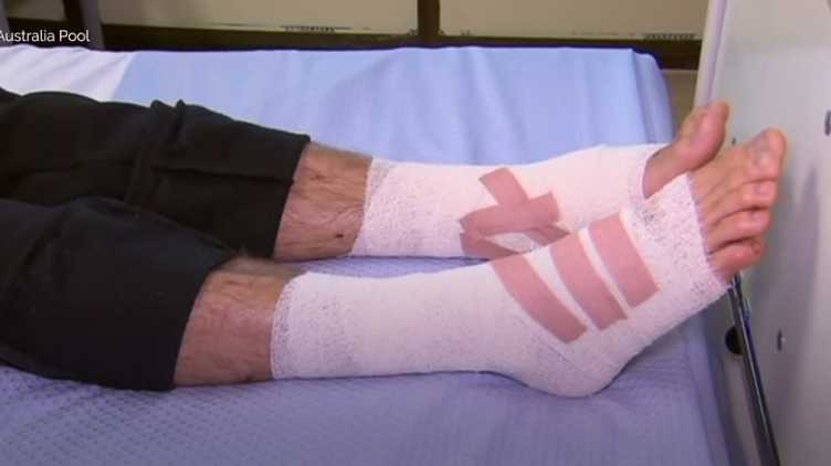 Teen’s feet left bloodied by strange sea creatures