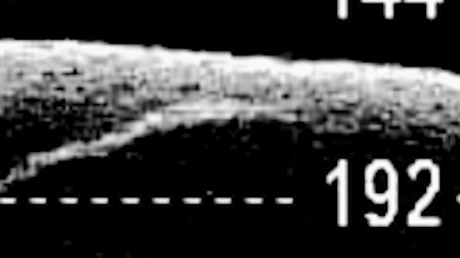 Woman believes she has sonar images of Champ Woman believes she has sonar images of Champ