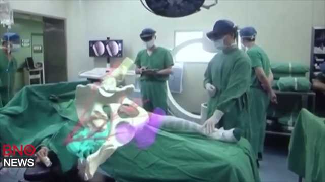 Doctors using holograms to aid orthopedic surgeries