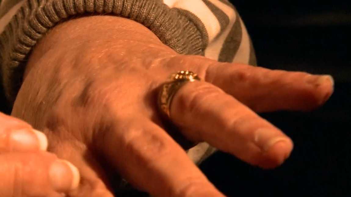 'And it still fits!' Woman reunited with lost ring after 35 years