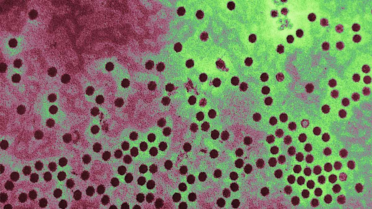 Common respiratory virus is on the rise, CDC warns, with higher risk ...