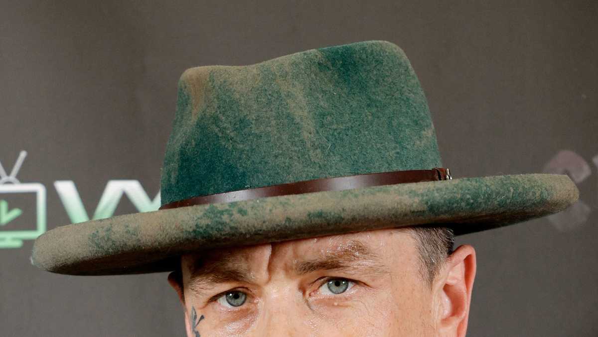 Slipknot band member sustains 'burns across his body’ in accident