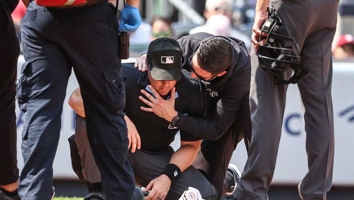 MLB Umpire taken off on a gurney after being struck by broken bat