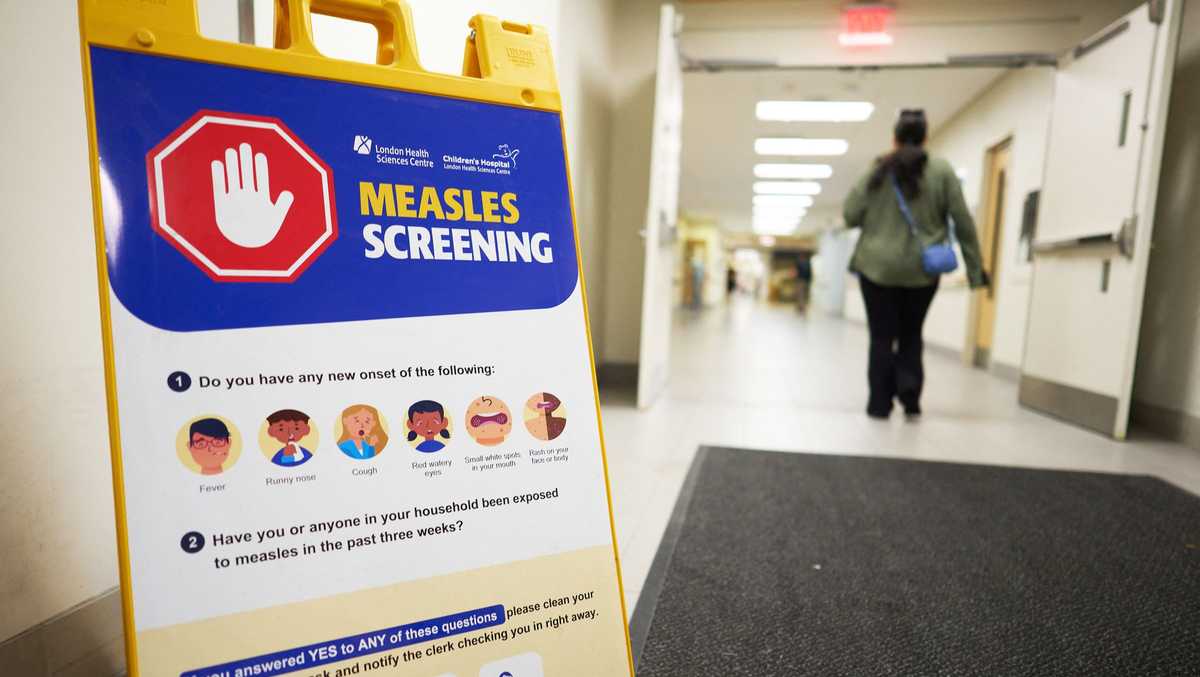 Canada poised to lose measles elimination status