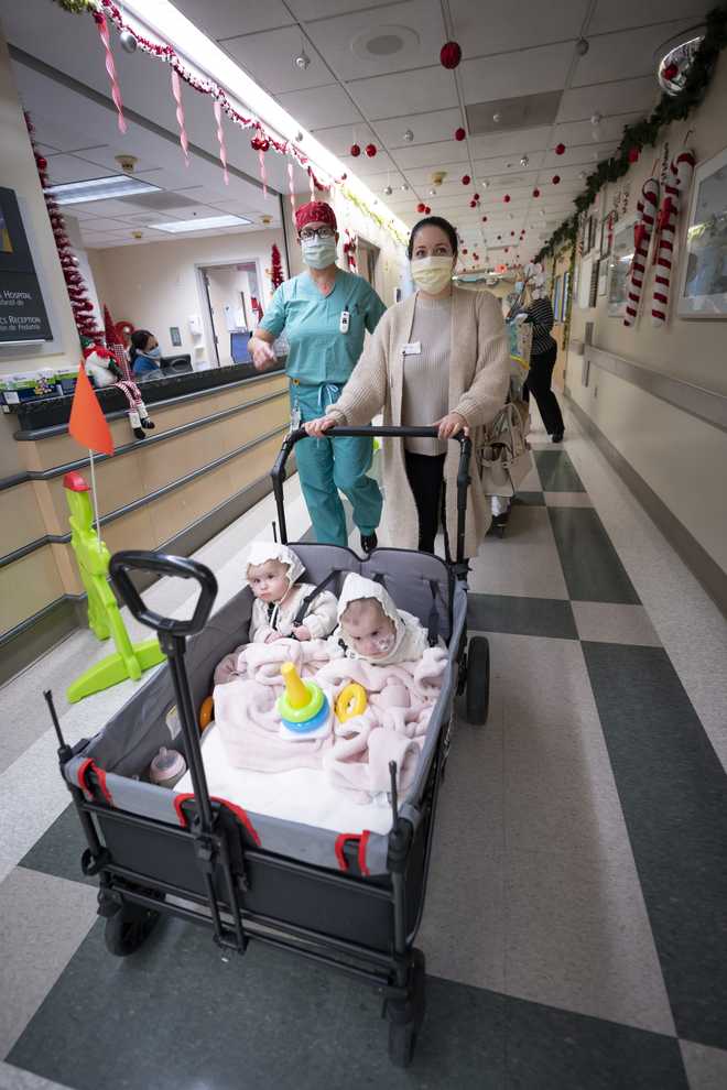 Previously conjoined Sacramento twins are home in time for Christmas