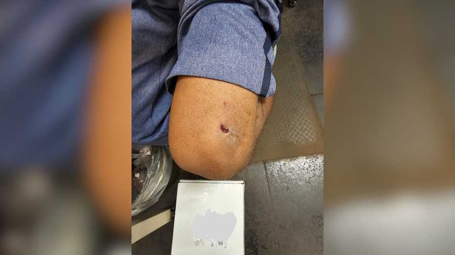 Letter carrier attacked by dog while delivering mail in Dedham