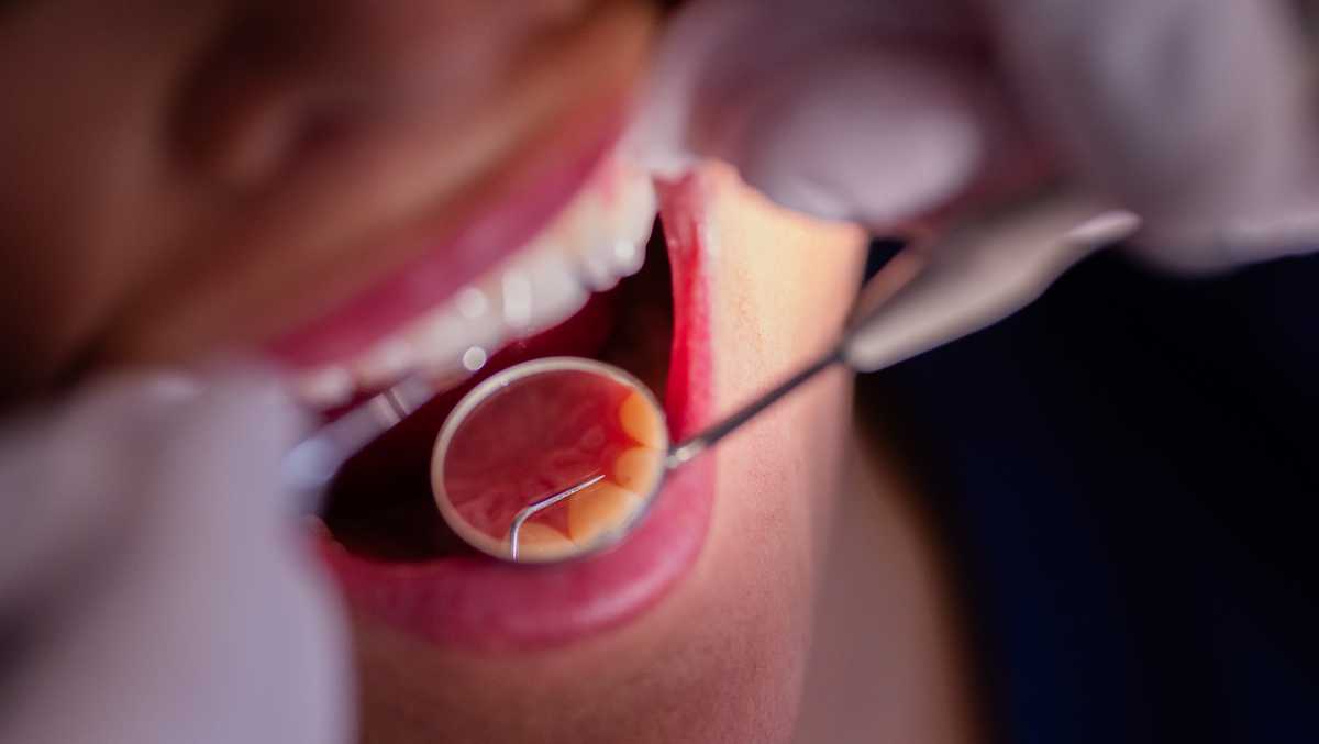 New dental insurance regulations take effect in 2024 in Mass.