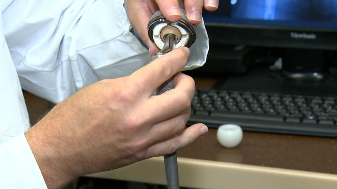 Hip replacement patients can consider dual-mobility implants