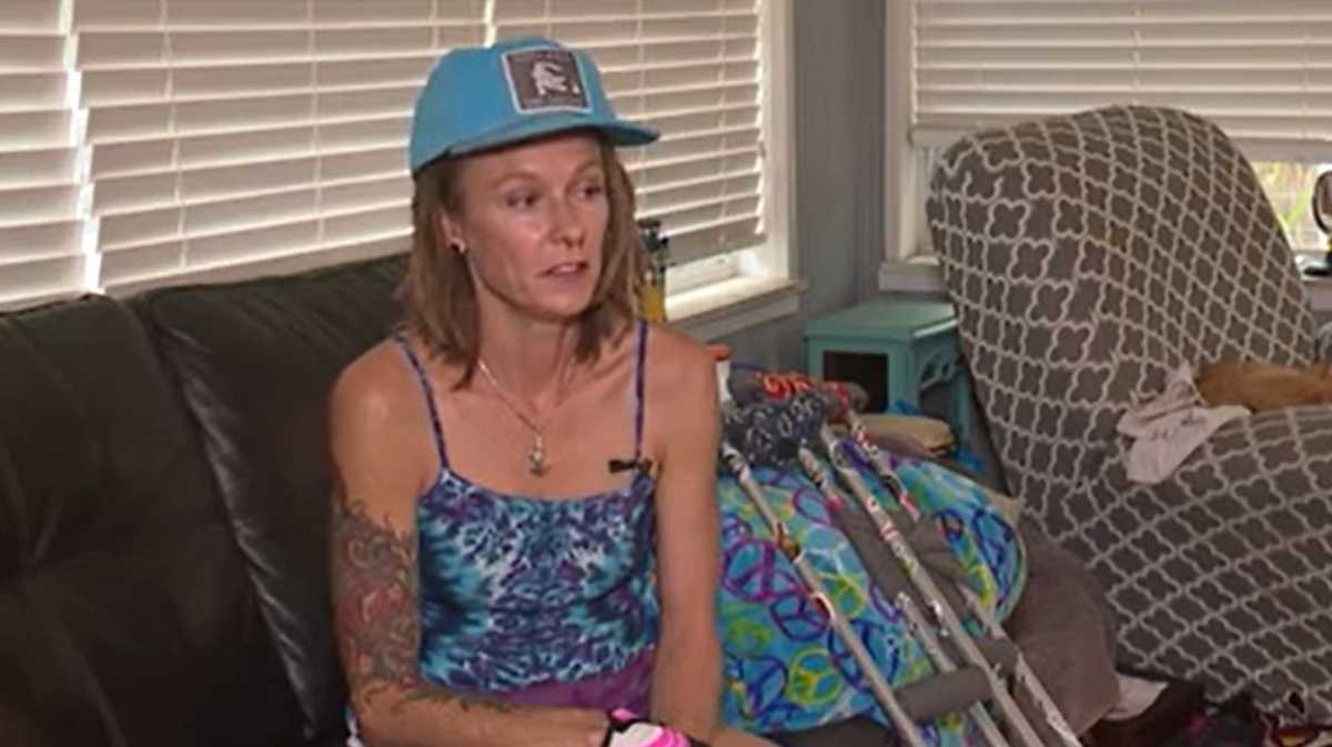 Florida woman talks about surviving alligator attack