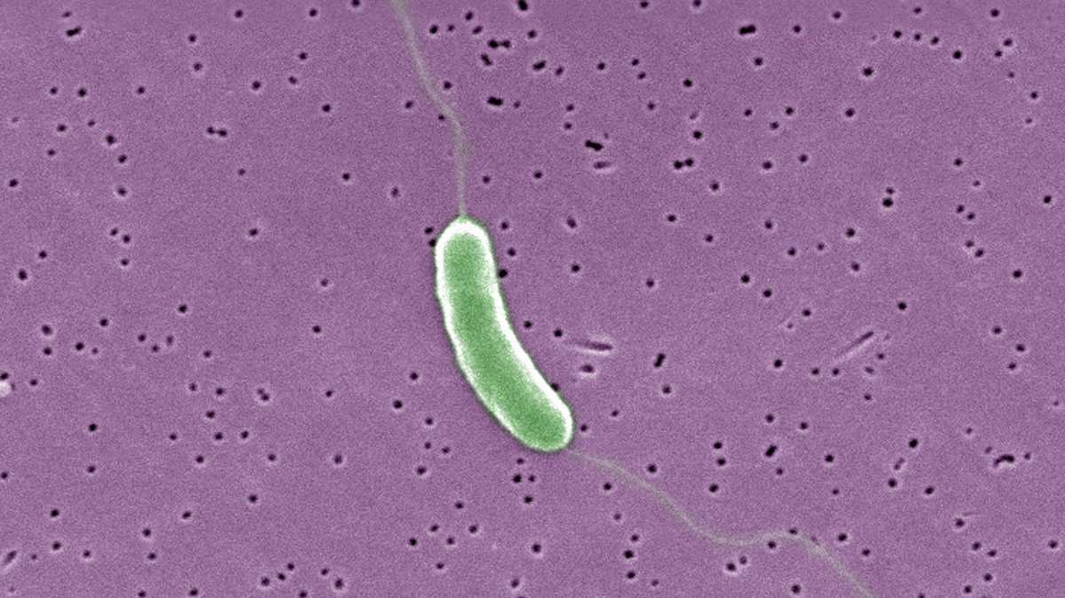 Fifth person dies in Florida from flesh-eating bacteria while vacationing