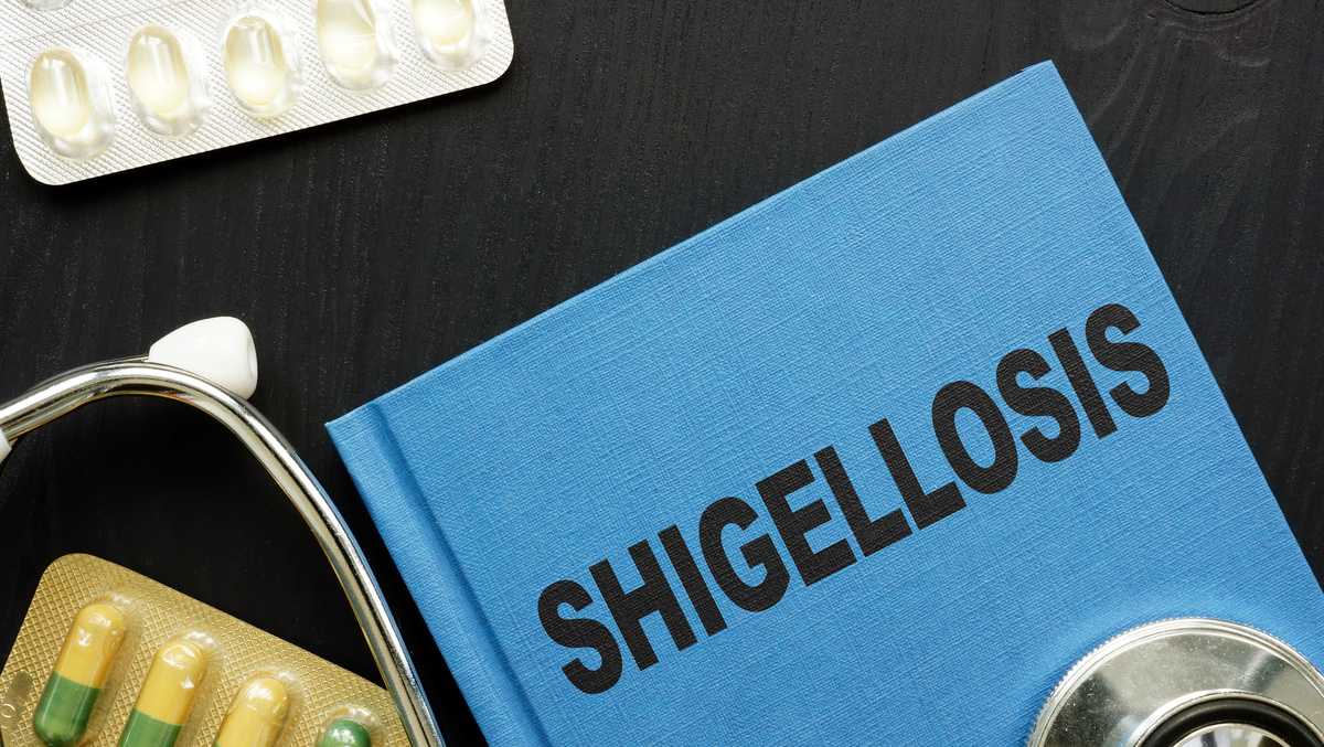 Shigellosis outbreak reported in a California city