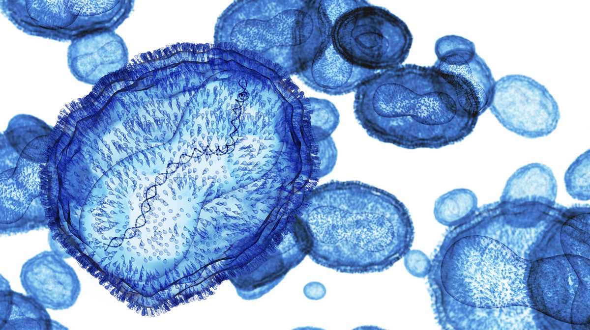 Indiana health officials report 45 monkeypox cases across the state