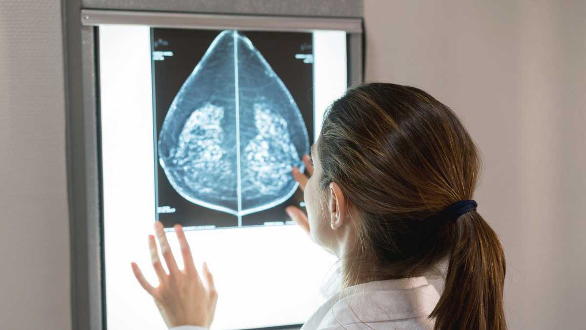 FDA approves first immunotherapy drug to treat breast cancer FDA approves first immunotherapy drug to treat breast cancer