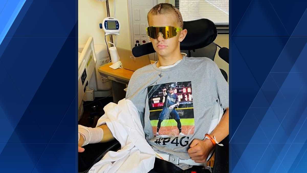 Progress for Trussville teen 8 weeks after suffering brain injury