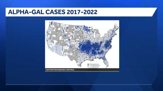 Local Alpha-gal expert speaks to 40/29 News