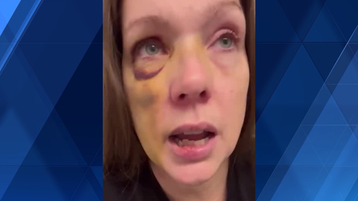 Woman assaulted in viral downtown brawl video speaks out for the first time