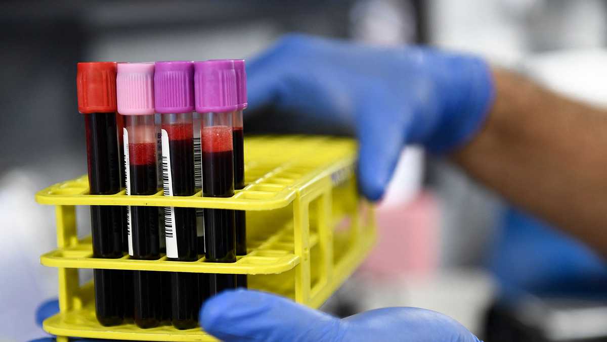 Study suggests HDL or ‘good’ cholesterol less beneficial than ...