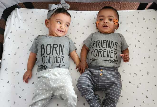 Siblings set record as the world's most premature twins Siblings set record as the world's most premature twins