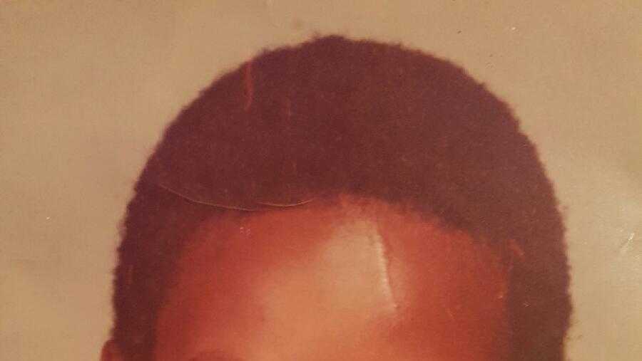 Man shares story of contracting HIV as child