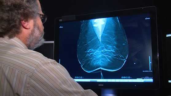 UC Health's new mammogram study will help save lives, health officials say
