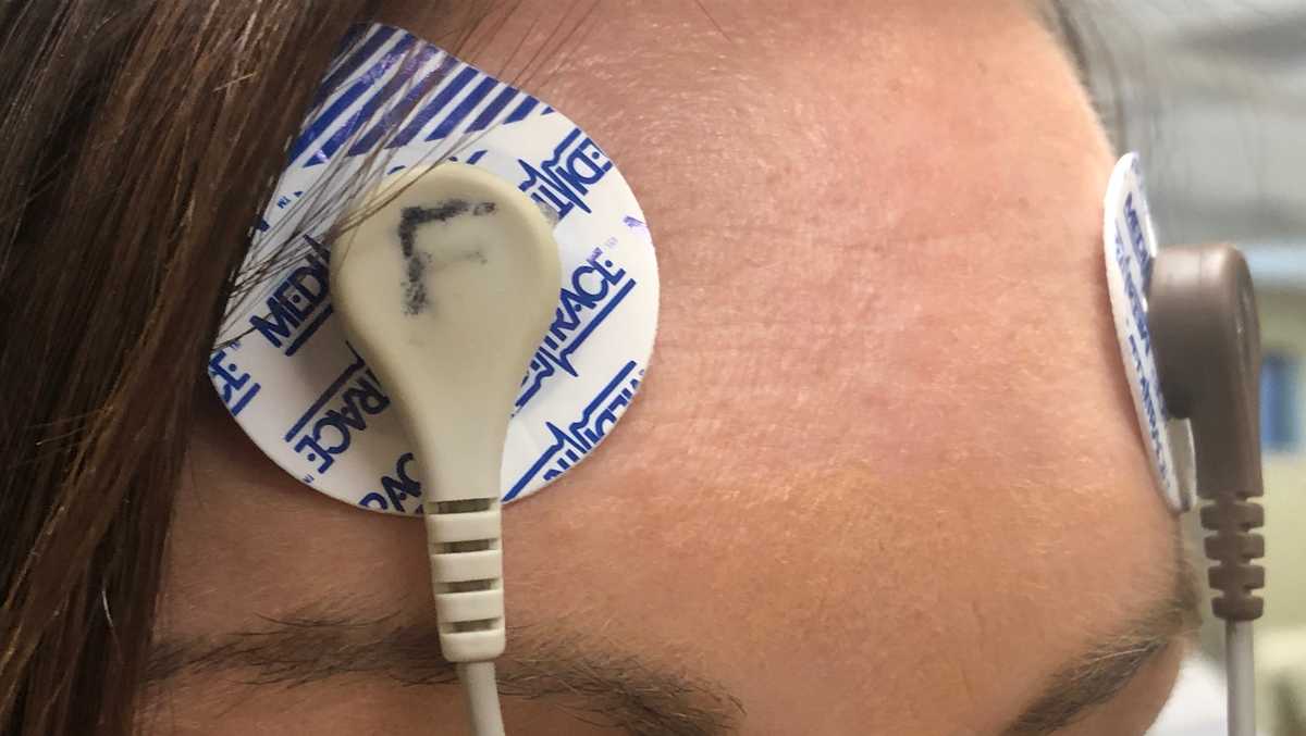 Explaining ECT: breaking the stigma on a mental health treatment for ...