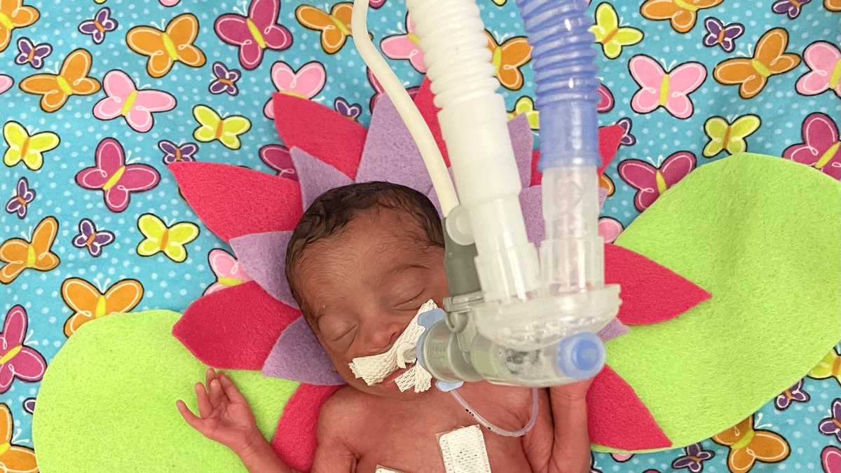 Brookwood Baptist's NICU babies dress up for Halloween