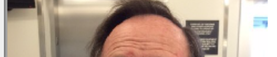 Manchester police search for man with Alzheimer's