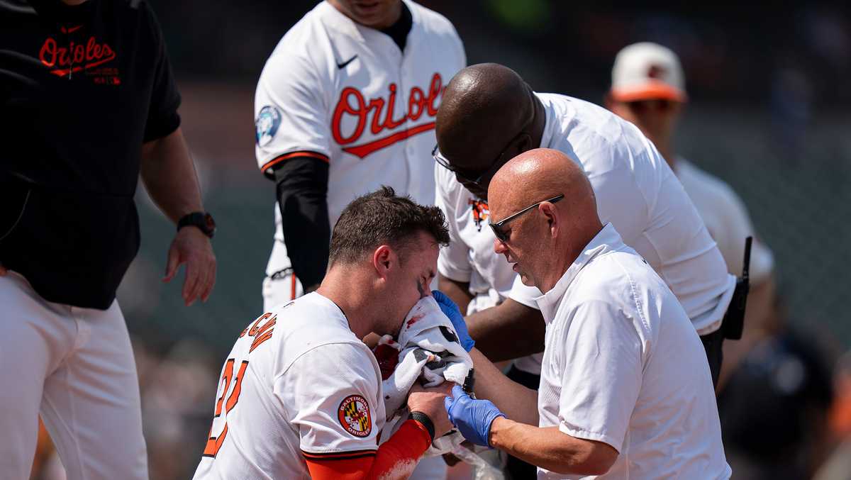 Orioles catcher James McCann hit by pitch to face