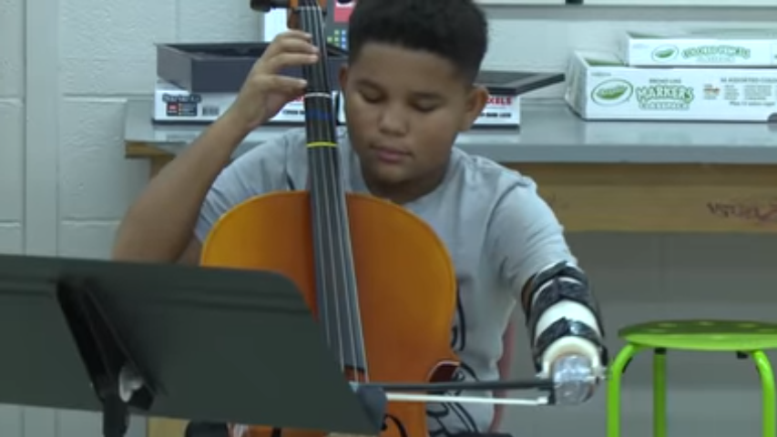 'Nothing has stopped him': High school student designs prosthesis so ...