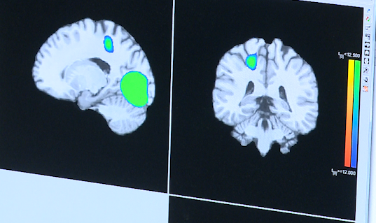 Power-lifting impacts brain in positive way