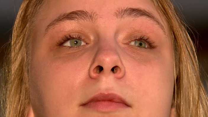 Woman Who Gouged Out Her Own Eyes Rediscovers Faith Finds New Vision