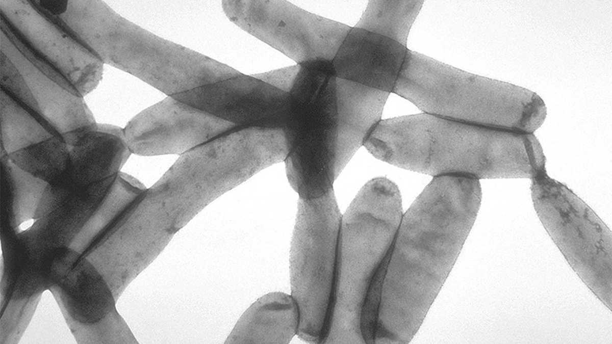 What you need to know about Legionnaires’ disease outbreak in NH