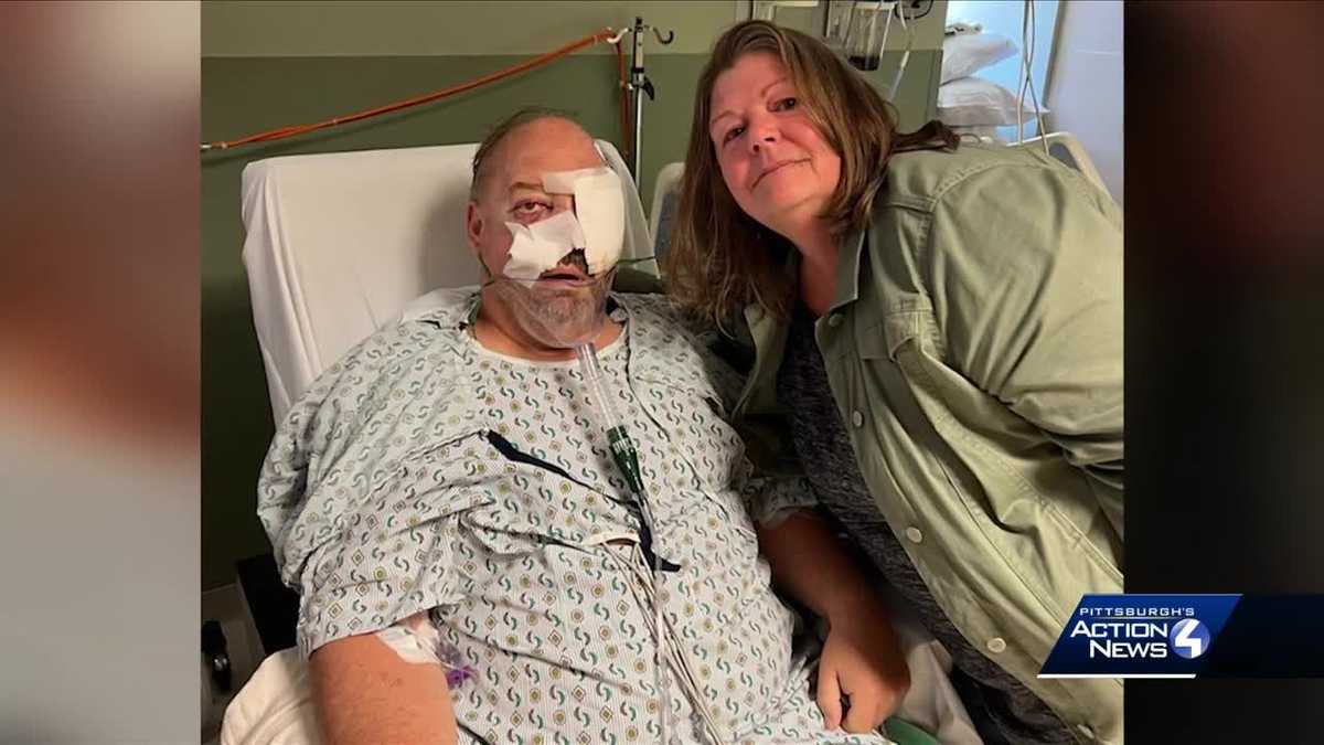 Pittsburgh police: I-376 shooting injures driver on Parkway West