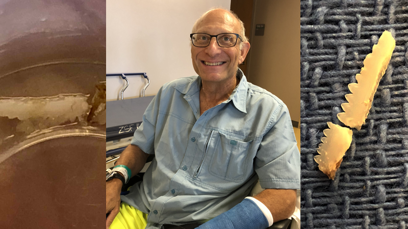 Pieces of tooth removed from doctor after shark attack on Cape Cod