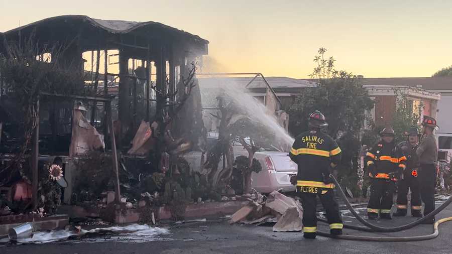 Man suffers second-degree burns during California fire