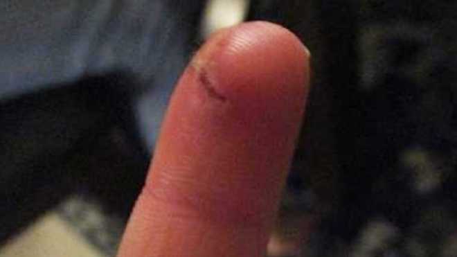 Monkey in high chair bites 8-year-old boy at restaurant