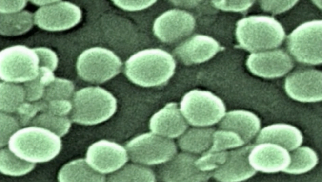 What is MRSA, and how do you know if you have it?