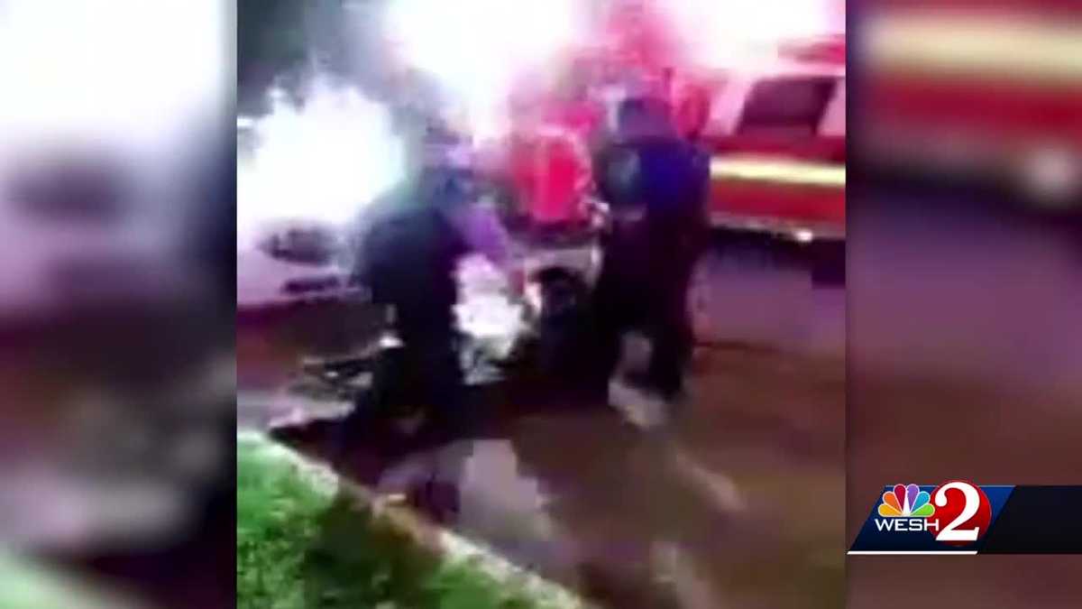 Brevard County man loses 2 fingers in fireworks accident