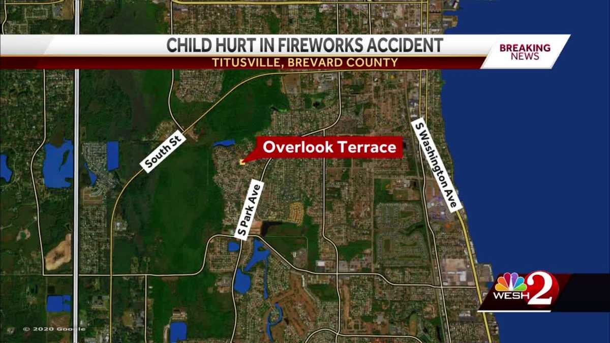 Child rushed to hospital after firework goes off in hand, officials say