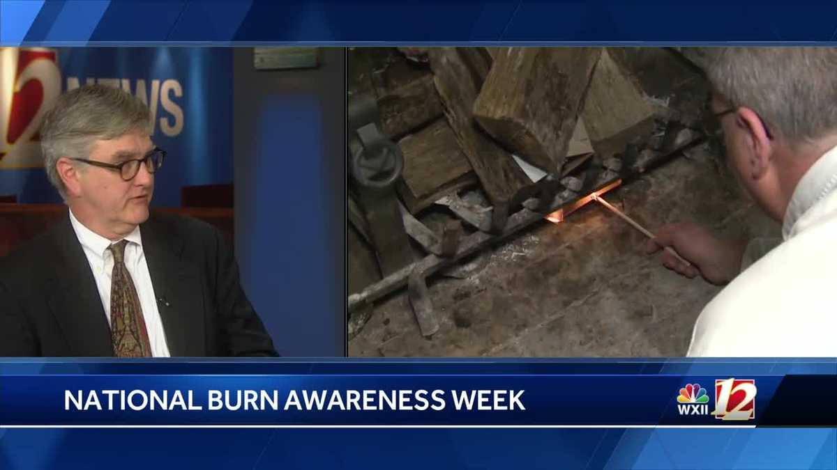 National Burn Awareness Week